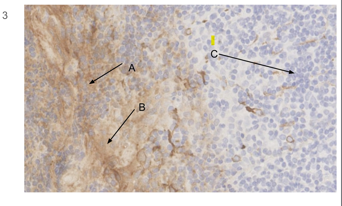 Solved Can you label this and describe the histology- ﻿liver | Chegg.com