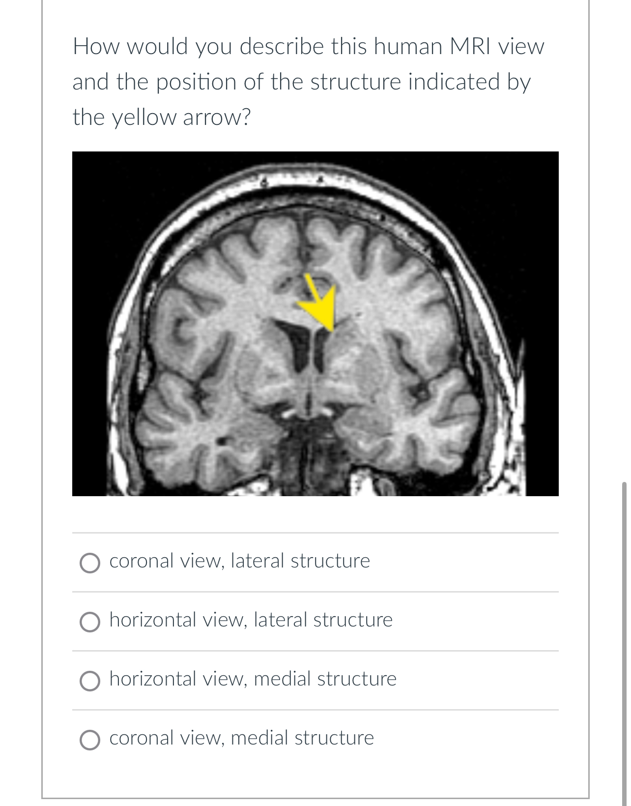 Solved How would you describe this human MRI view and the | Chegg.com