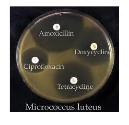 Solved Amoxicillin Doxycyclind Ciprofloxacin Tetracycline | Chegg.com