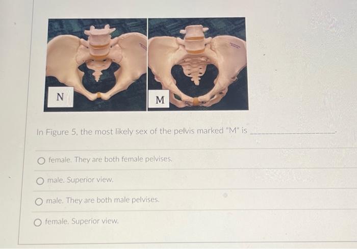 In Figure 5 The Most Likely Sex Of The Pelvis Marked