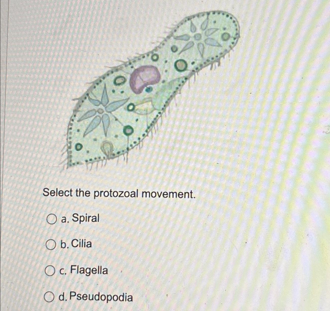 Solved Select the protozoal movement.a. ﻿Spiralb. ﻿Ciliac. | Chegg.com