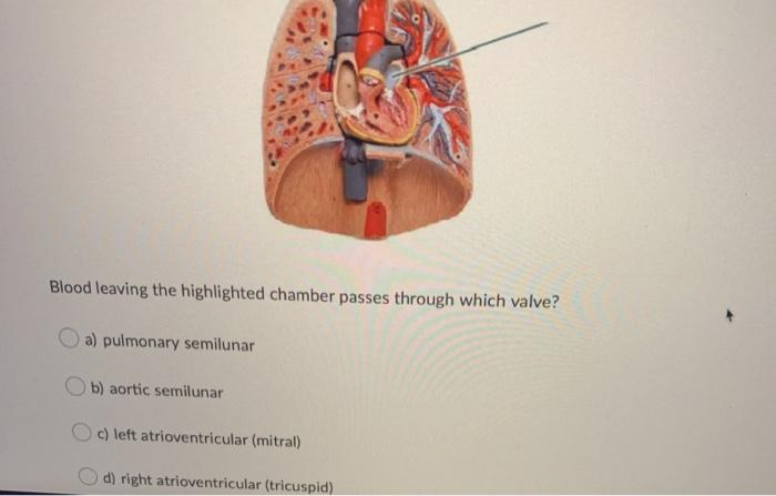 Solved Which chamber is highlighted? a) right ventricle b) | Chegg.com