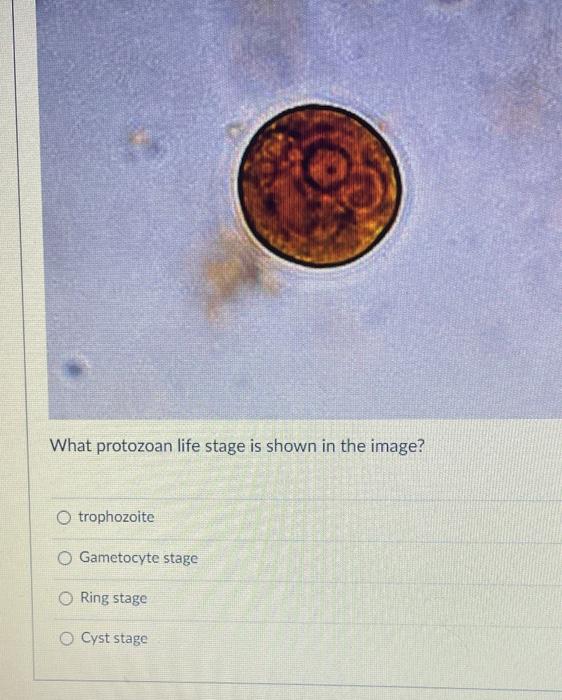 Solved What protozoan life stage is shown in the image? | Chegg.com