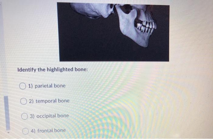 Solved Identify the highlighted bone: 1) parietal bone | Chegg.com