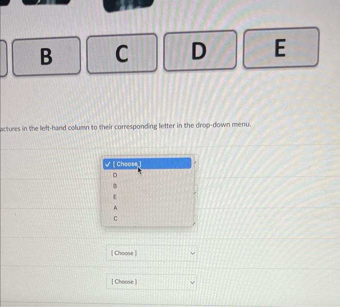 [Solved]: Match the type of bone fractures in the left-hand