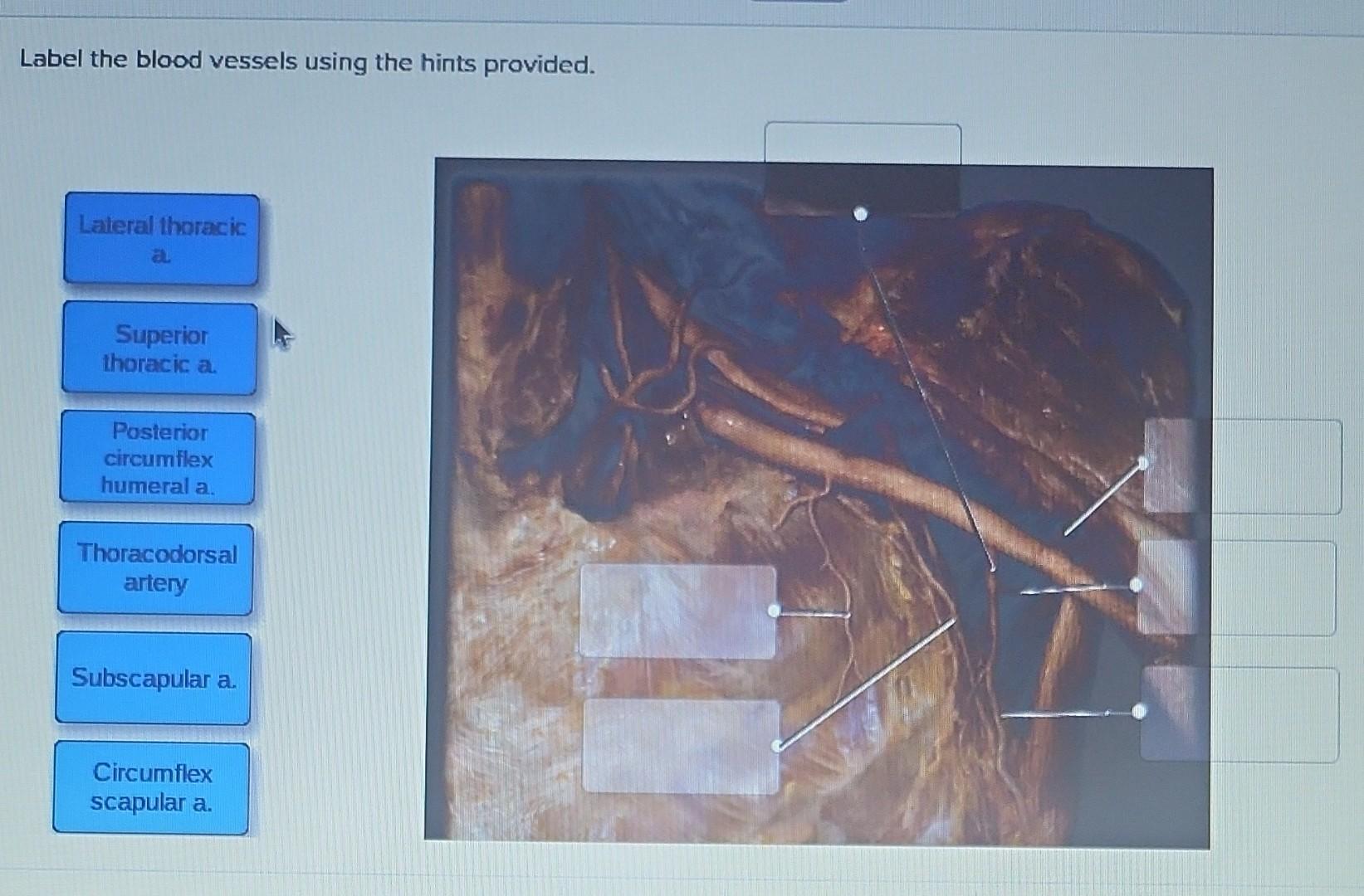 Solved Label the blood vessels using the hints provided. | Chegg.com