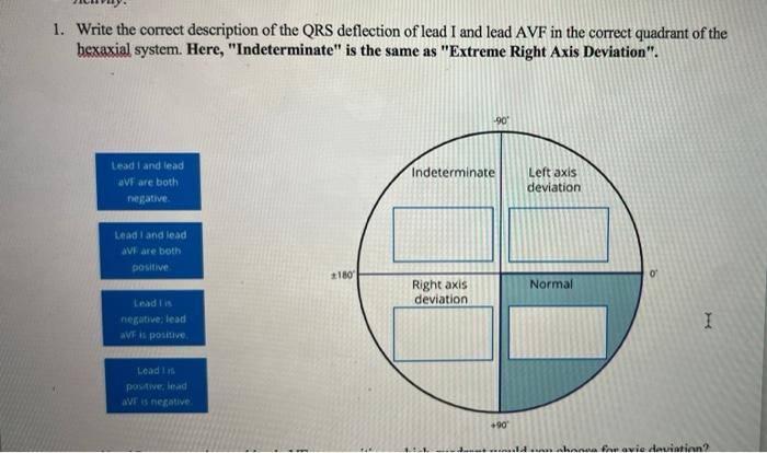 Solved 1. Write the correct description of the QRS | Chegg.com