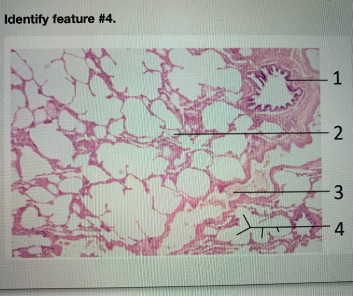 Solved Identify feature #4. | Chegg.com