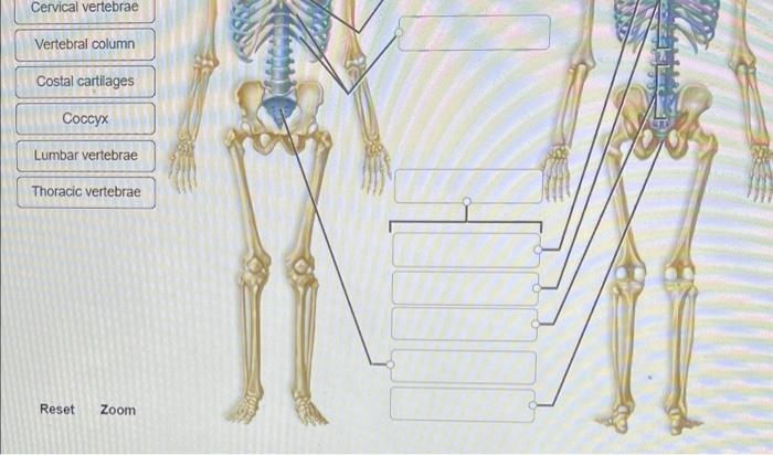 Solved Correctly label the following bones of the axial | Chegg.com