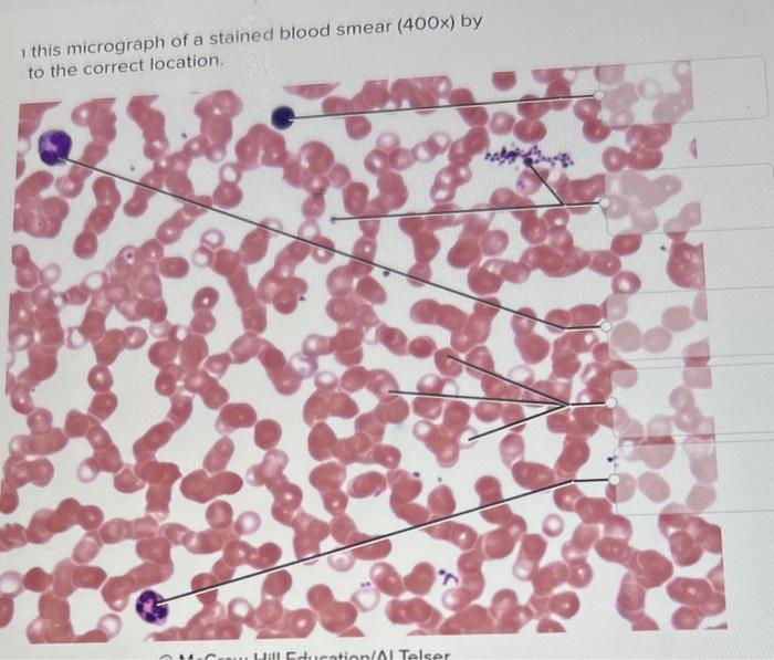 Solved I this micrograph of a stained blood smear (400x) by | Chegg.com