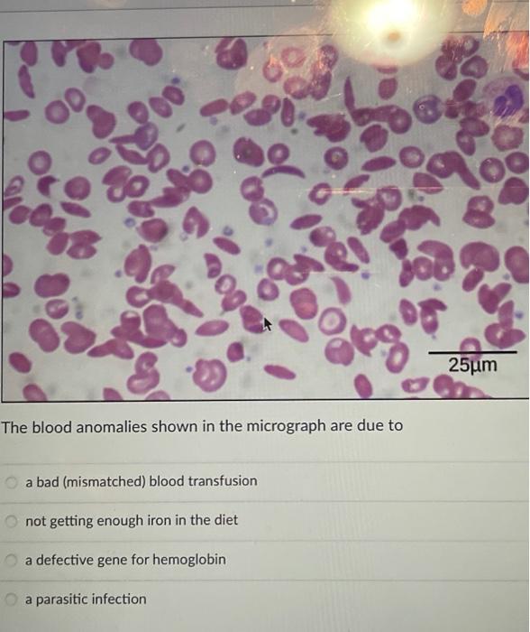 Solved booo 8 25um The blood anomalies shown in the | Chegg.com