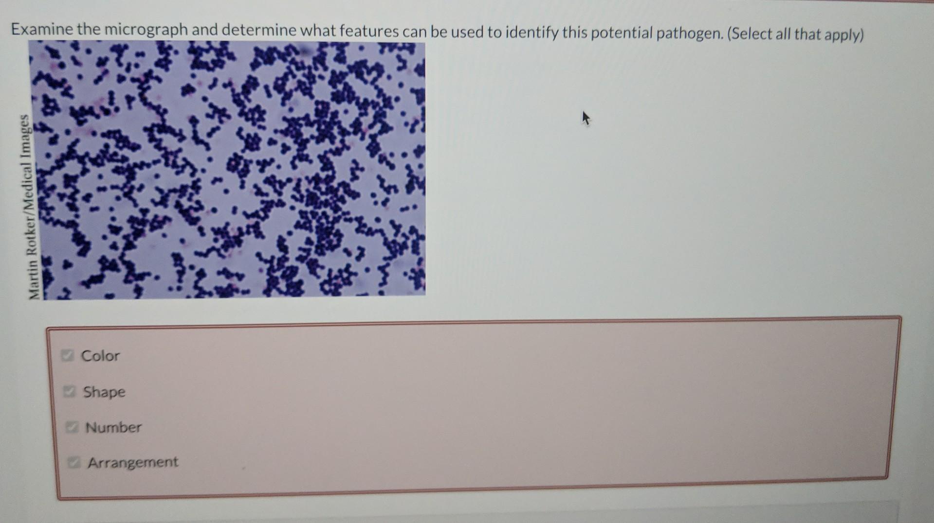 Solved Examine the micrograph and determine what features | Chegg.com