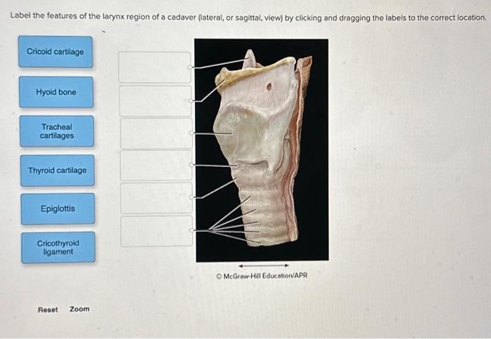 Solved Label the features of the larynx region of a cadaver | Chegg.com