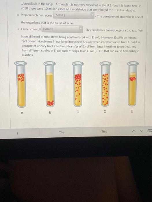 Solved The following organisms were inoculated in a tube | Chegg.com