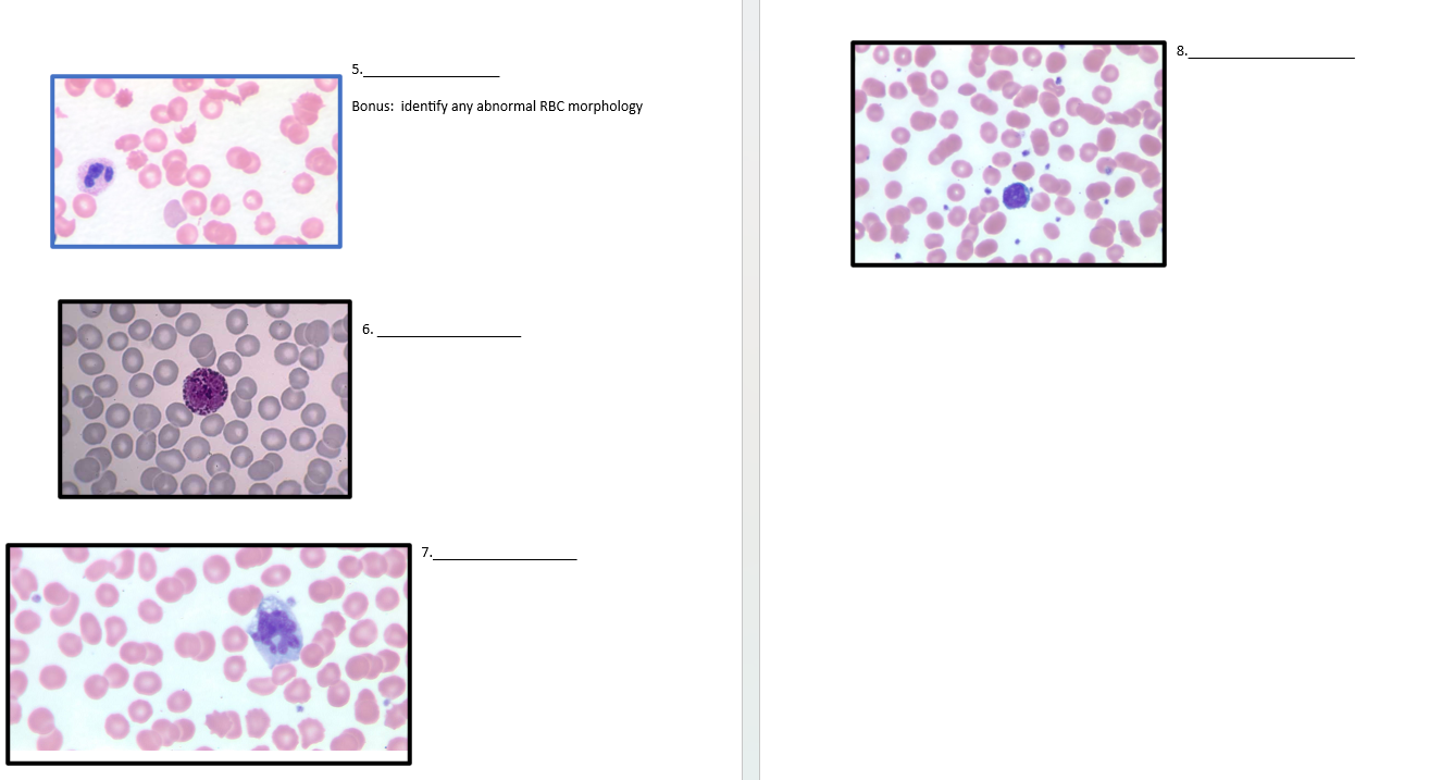 Solved #5: IDENTIFY EACH WHITE BLOOD CELL#6, ﻿#7, ﻿#8: | Chegg.com