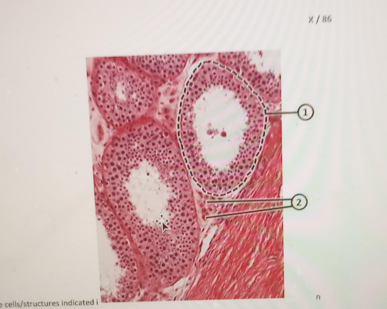 Solved identify the cells/structures indicated in the image | Chegg.com Solved identify the cells/structures indicated in the image | Chegg.com