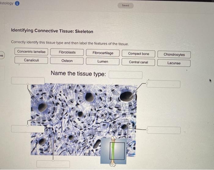 Solved Histology Saved Identifying Connective Tissue: | Chegg.com