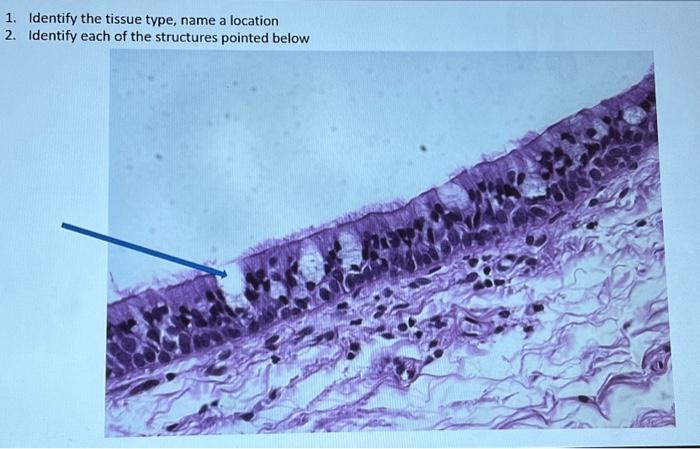 Solved 1. Identify the tissue type, name a location 1. | Chegg.com Solved 1. Identify the tissue type, name a location 1. | Chegg.com