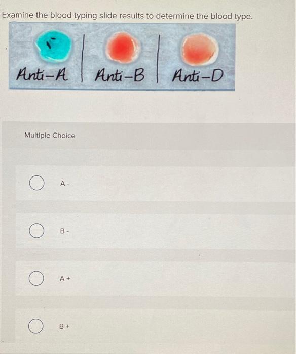 Solved Examine the blood typing slide results to determine | Chegg.com