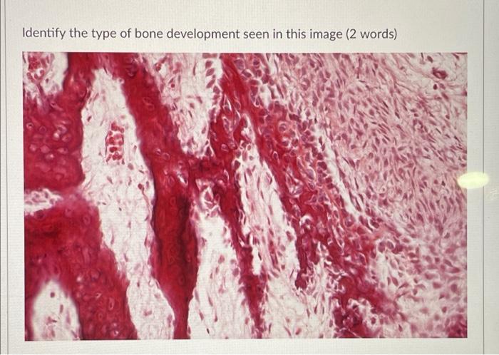 Solved Identify the structure indicated by the pointer | Chegg.com