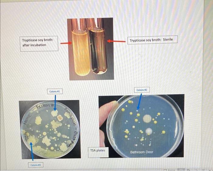 Solved Trypticase soy broth: after incubation Trypticase soy | Chegg.com