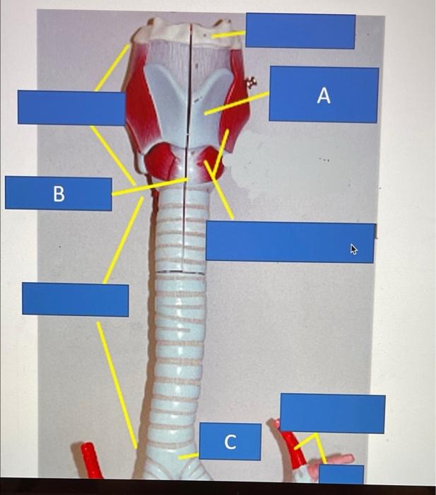 Solved B с К A J D 1. Lobar bronchi are labeled what | Chegg.com