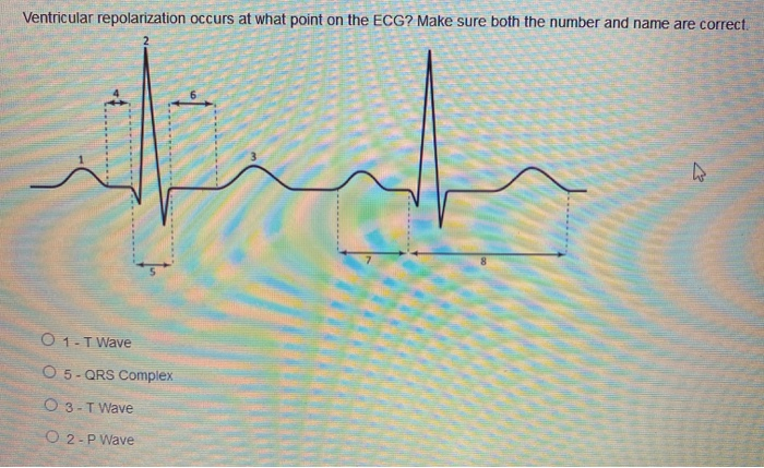 Solved Ventricular repolarization occurs at what point on | Chegg.com