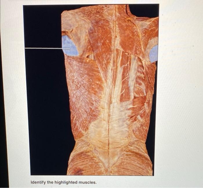 Solved Identify the highlighted muscles. LT-VA 16: | Chegg.com