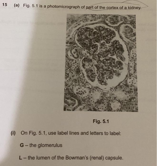 Solved (a) Fig. 5.1 is a photomicrograph of part of the | Chegg.com