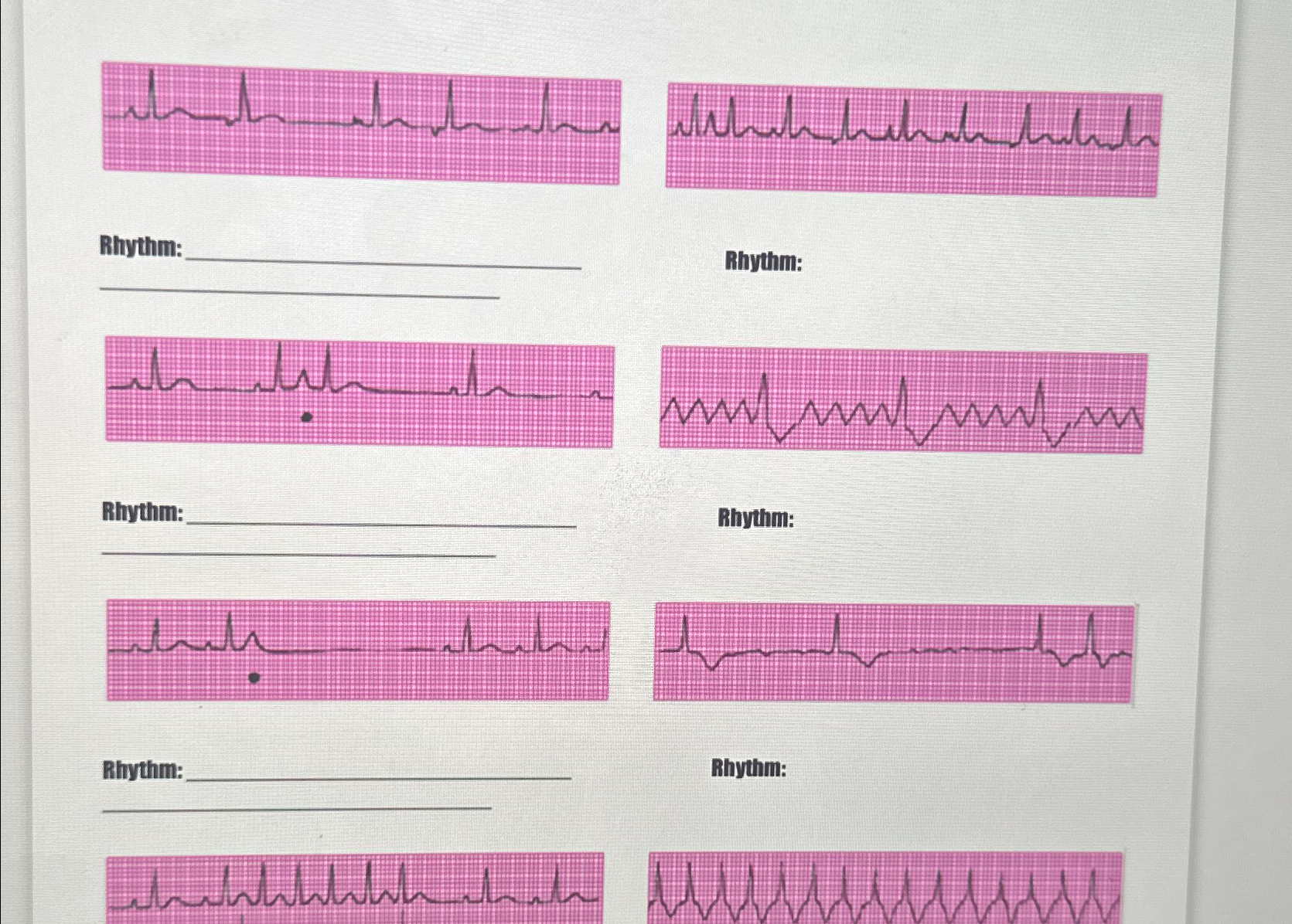 Solved Determine the rhythm name on the enlarged strips | Chegg.com