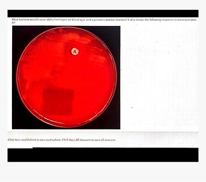 Solved What bacteria would cause alpha hemolysis on blood | Chegg.com