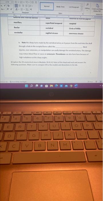 Solved Hebeck a heile in the ixcope ai hone calked the b. | Chegg.com