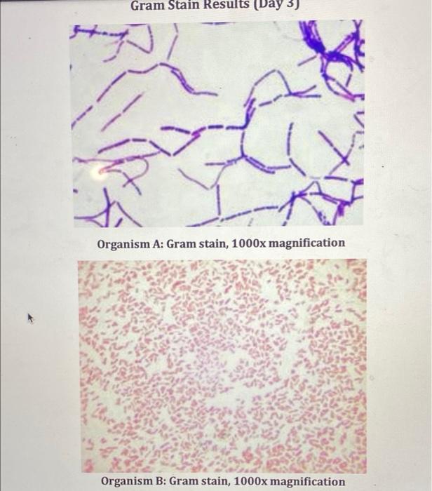 Proteus Vulgaris Gram Stain 1000x