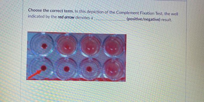 Solved Choose the correct term. In this depiction of the | Chegg.com