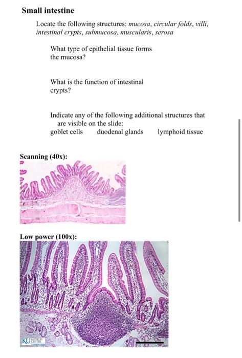 Solved Small intestine Locate the following structures: | Chegg.com