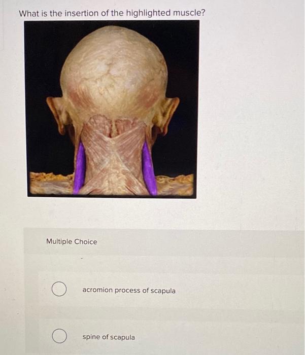 Solved What is the insertion of the highlighted muscle? | Chegg.com
