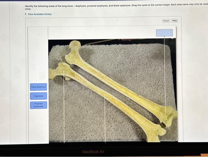 Solved Identify the following areas of the long bone - | Chegg.com