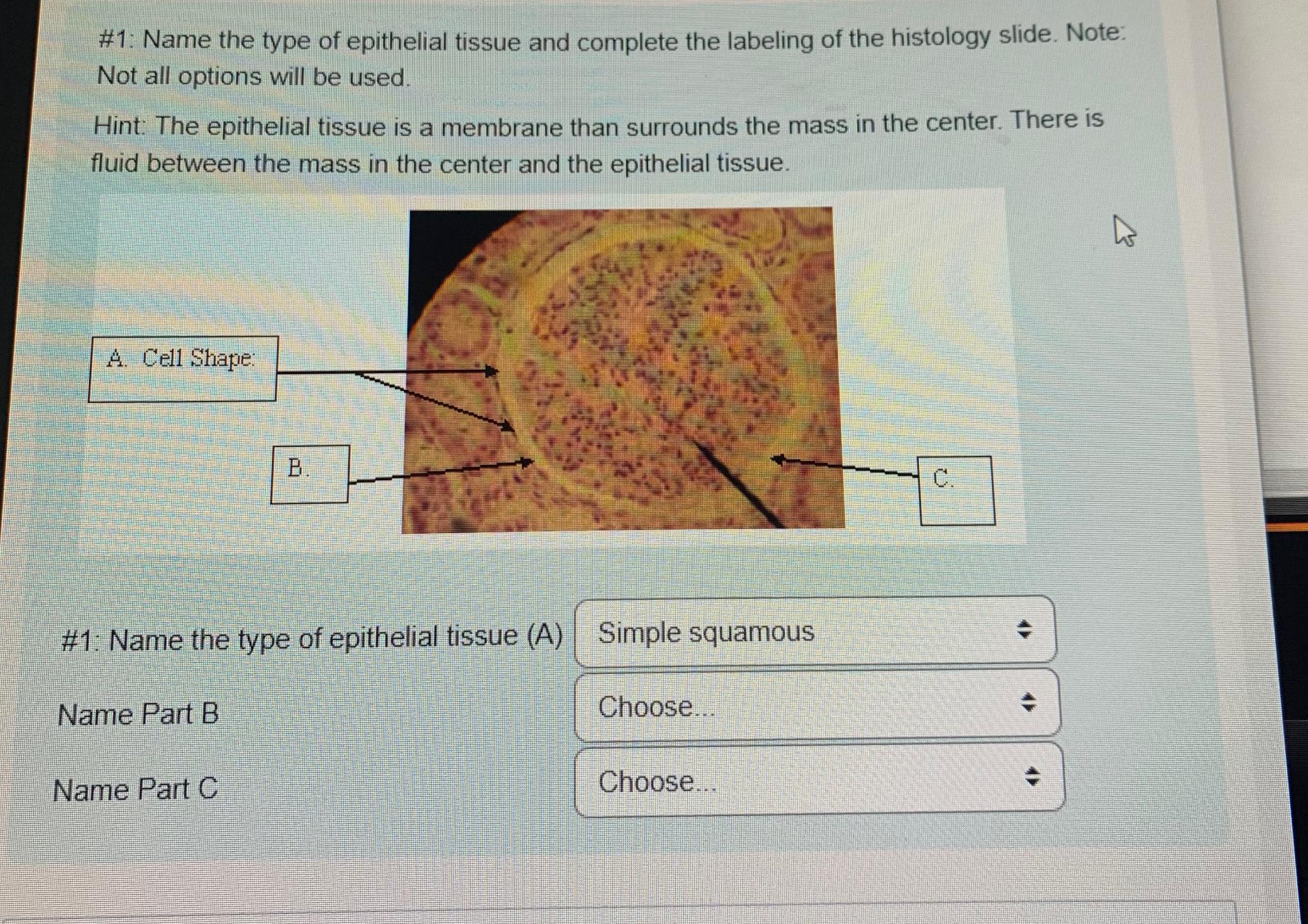 Solved #1: Name the type of epithelial tissue and complete | Chegg.com