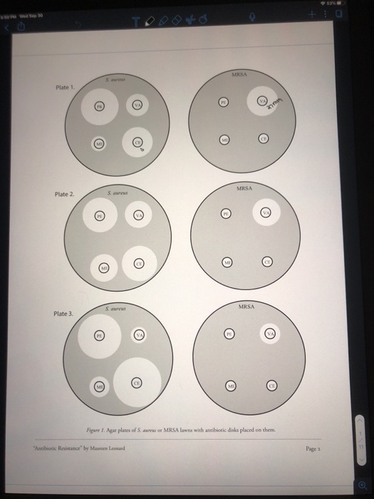 MRSA Plate 1 ann MRSA Plate 2 Sa Sur MRSA Plate 3 | Chegg.com