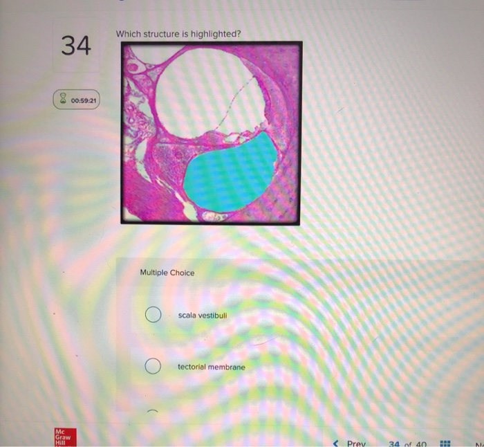Solved Which structure is highlighted? 34 8 00:59:21 | Chegg.com