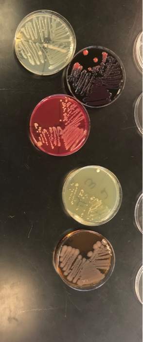 Solved I think my bacteria is enterobacter aerogenes/ k | Chegg.com