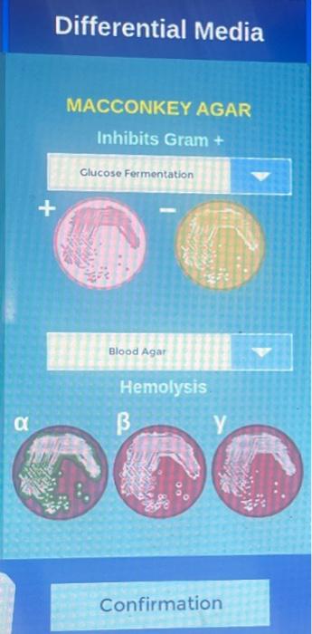 Solved a Differential Media + MACCONKEY AGAR Inhibits Gram + | Chegg.com