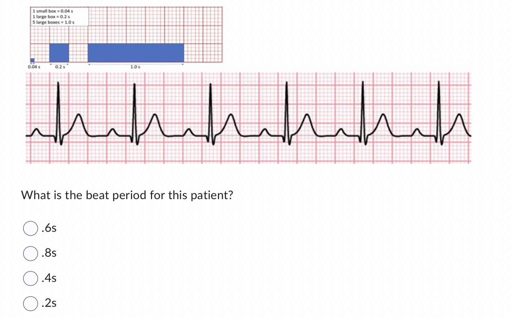 Solved What is the beat period for this patient?.6s.8s.4s.2s | Chegg.com