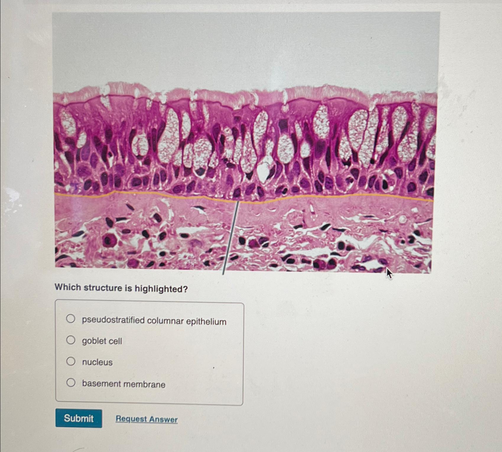 Solved Which structure is highlighted?pseudostratified | Chegg.com