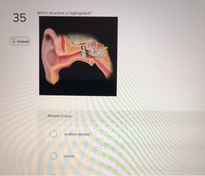 Solved Which structure is highlighted? 35 X 00:58:48 | Chegg.com