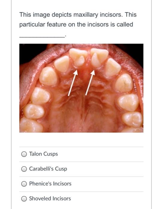 Solved This image depicts maxillary incisors. This | Chegg.com