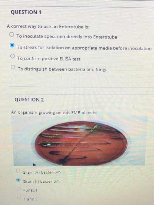 Solved QUESTION 1 A correct way to use an Enterotube is: To | Chegg.com