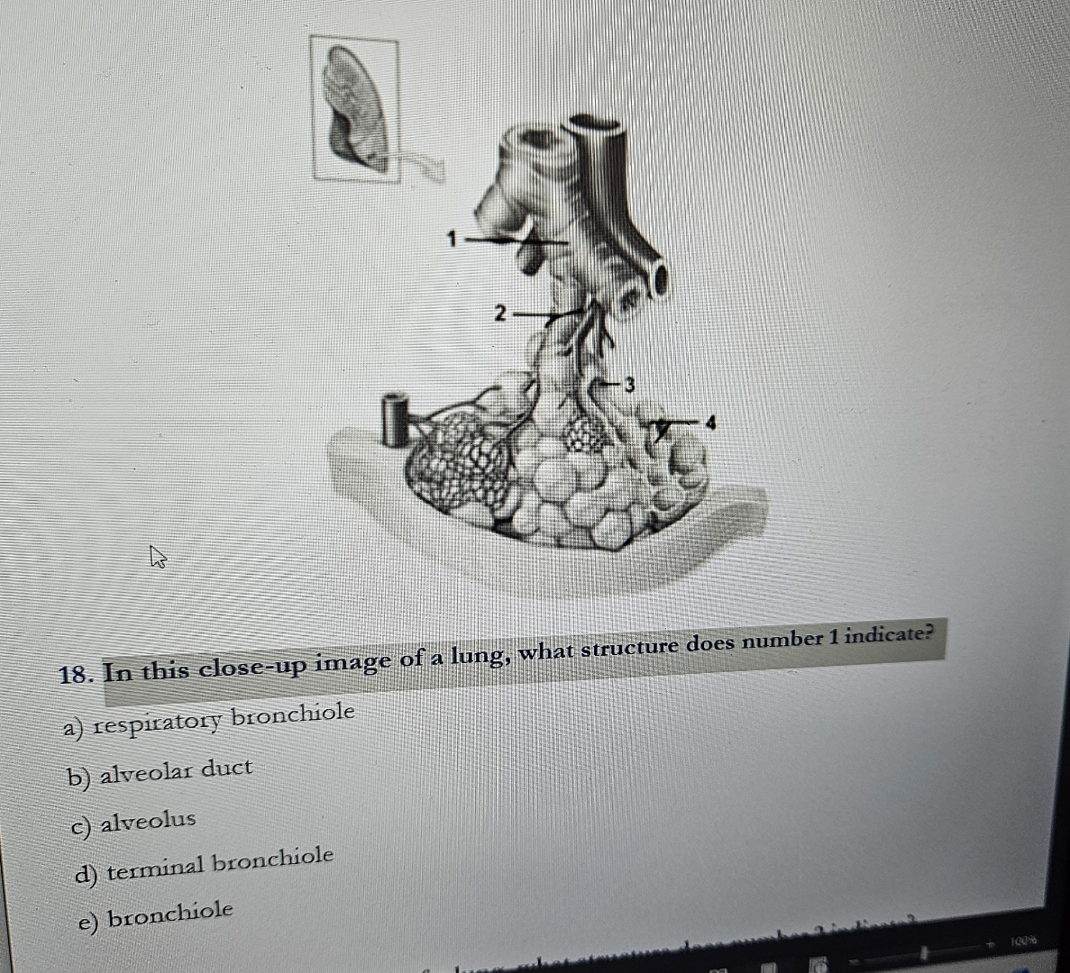 Solved In this close-up image of a lung, what structure does | Chegg.com