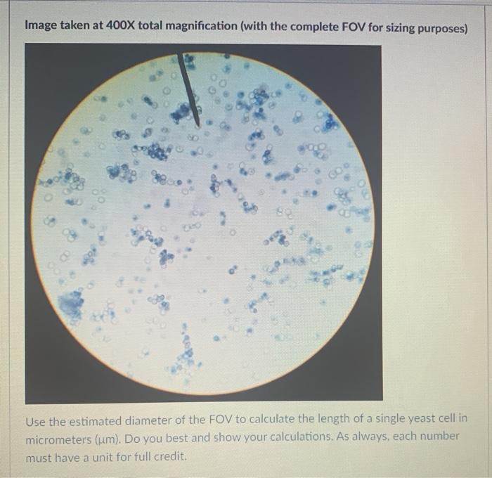 Solved Image taken at 400X total magnification (with the | Chegg.com
