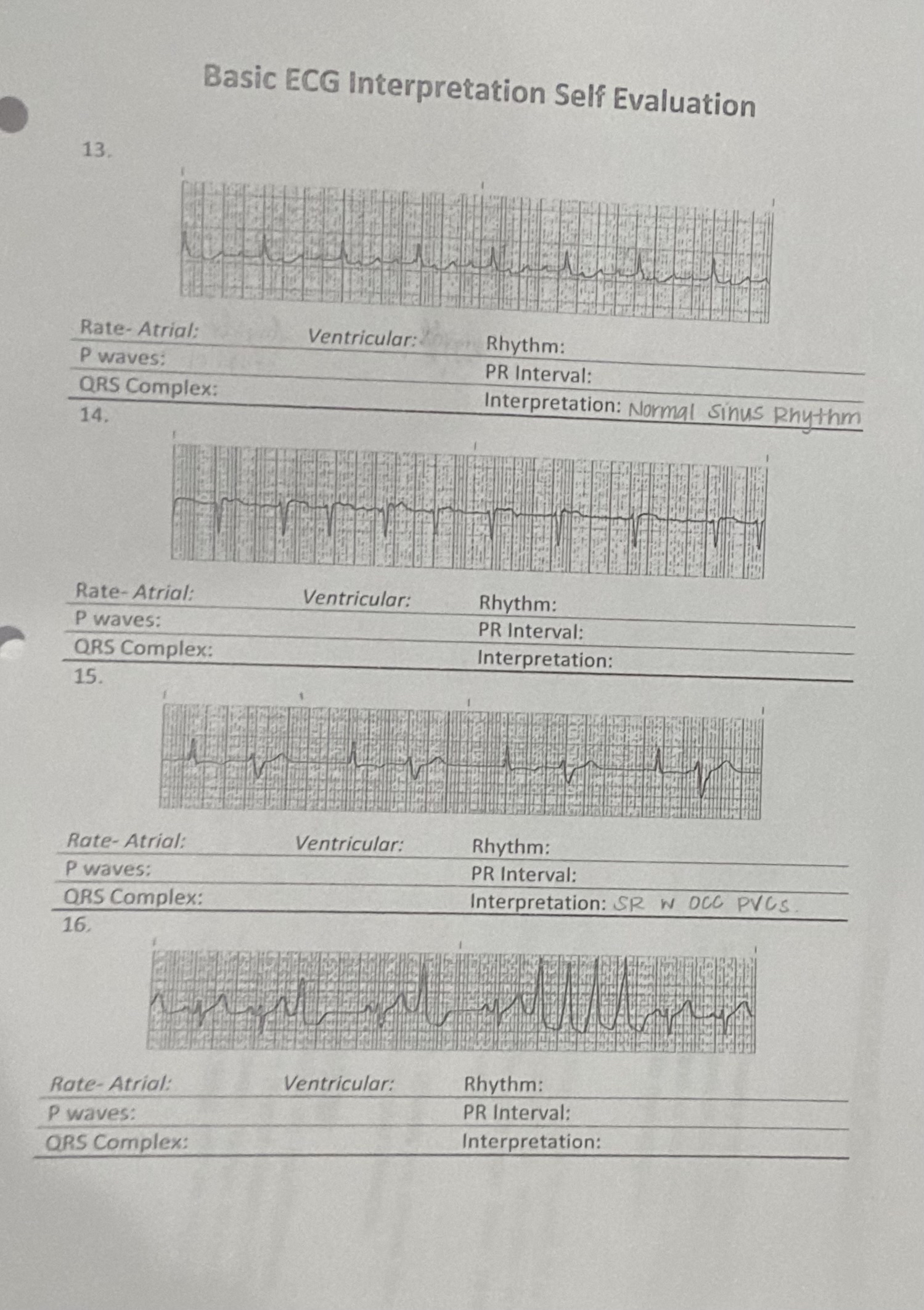 Solved Basic ECG Interpretation Self Evaluation13.RateP | Chegg.com